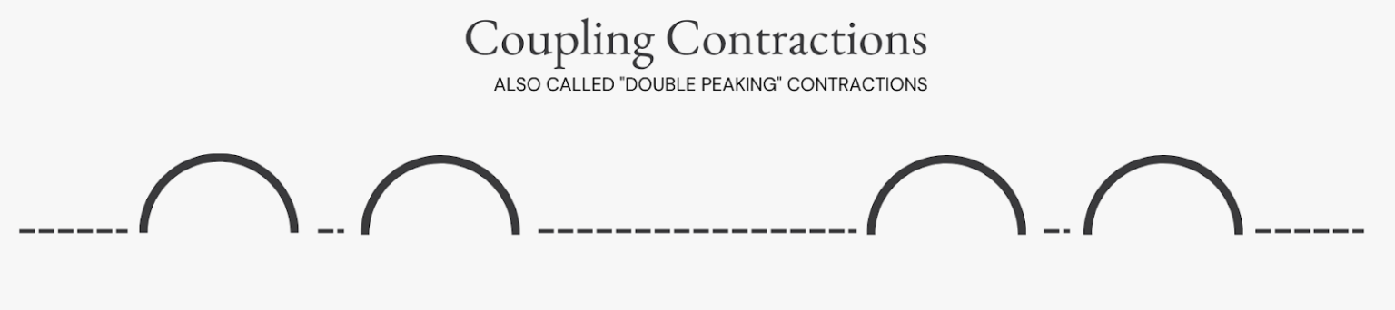 What is Back Labor and What To Do About It?